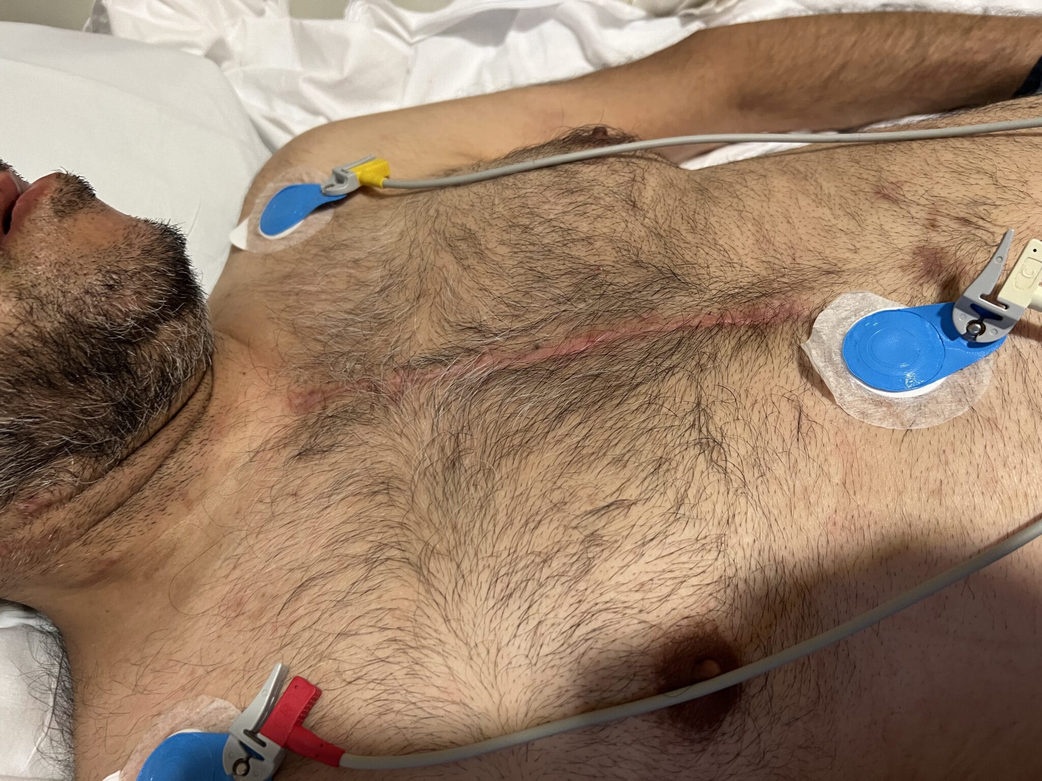 MRCP PACES Exam Dates and Preparation Time 2025: Everything You Need To ...