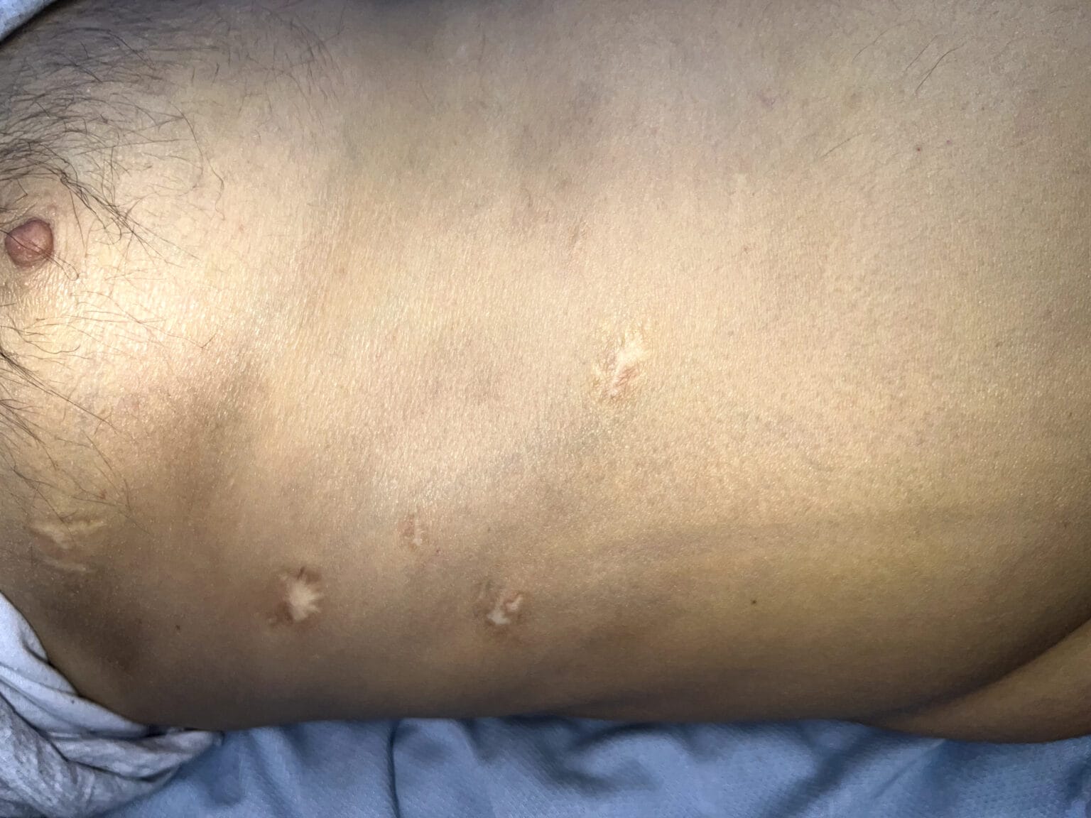 PACES AID | High-Yield MRCP PACES Revision Guide